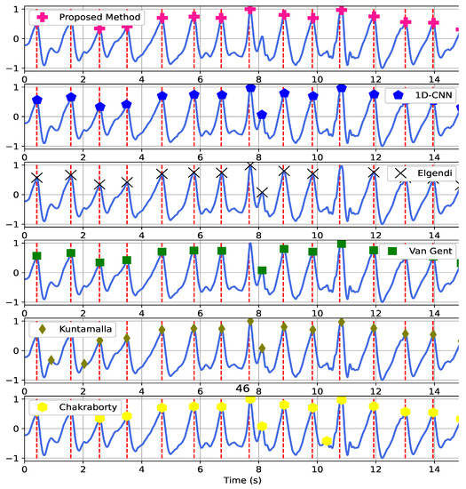 Robust PPG Peak Detection Using Dilated Convolutional Neural Networks