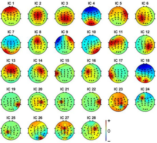 Sensors | Free Full-Text | Improving EEG-Based Driver Distraction Classification Using Brain ...