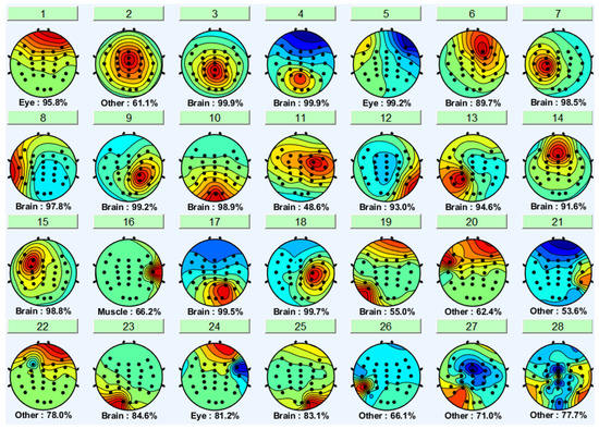 Sensors | Free Full-Text | Improving EEG-Based Driver Distraction Classification Using Brain ...