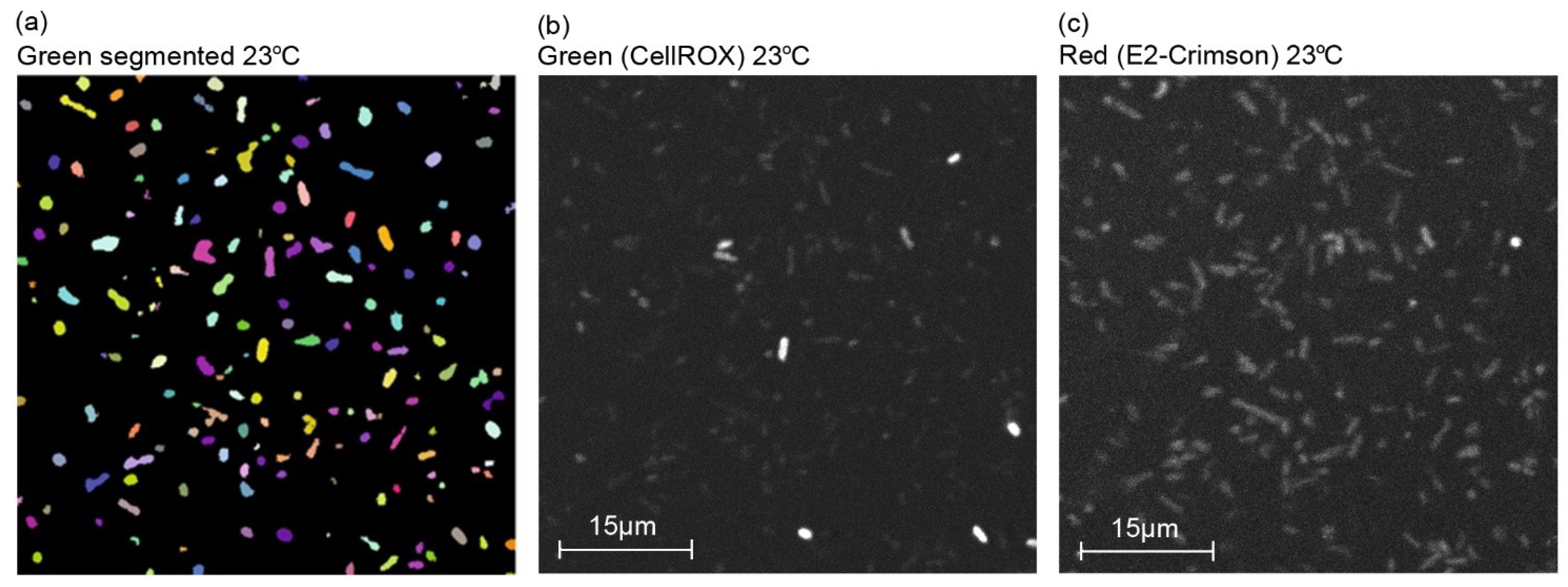 A Plasmid-Based Fluorescence Reporter System for Monitoring Oxidative ...