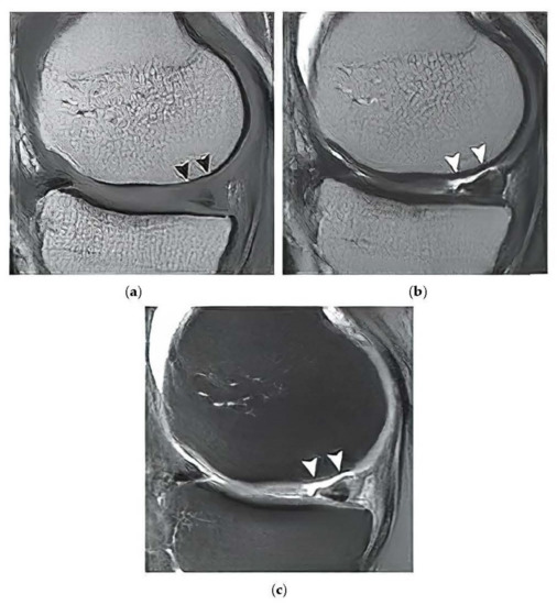 Sensors | Free Full-Text | Performance and Robustness of Regional Image Segmentation Driven by ...