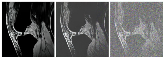 Sensors | Free Full-Text | Performance and Robustness of Regional Image Segmentation Driven by ...