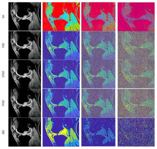 Sensors | Free Full-Text | Performance and Robustness of Regional Image Segmentation Driven by ...