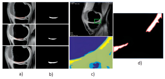 Sensors | Free Full-Text | Performance and Robustness of Regional Image Segmentation Driven by ...