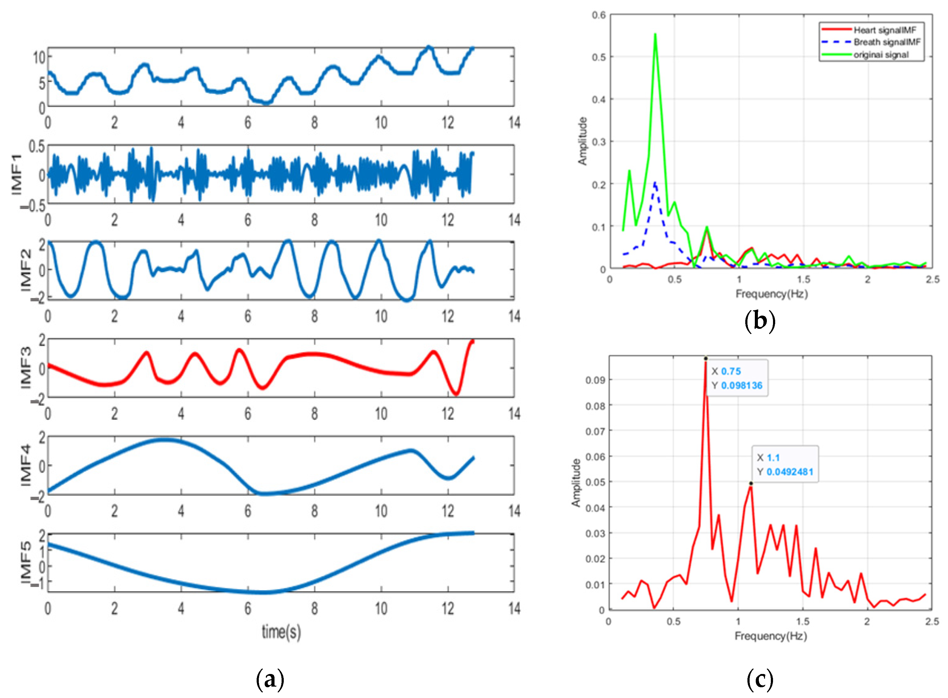 Sensors | Free Full-Text | Non-Contact Detection of Vital Signs Based ...
