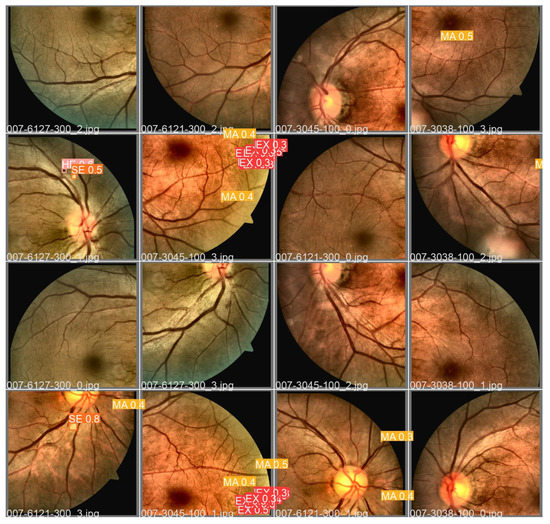 Sensors | Free Full-Text | A New Approach for Detecting Fundus Lesions ...