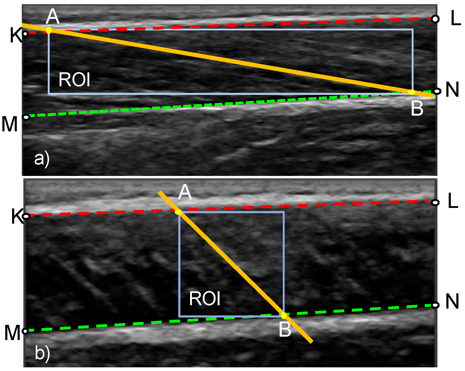 Automated Method for Tracking Human Muscle Architecture on Ultrasound ...