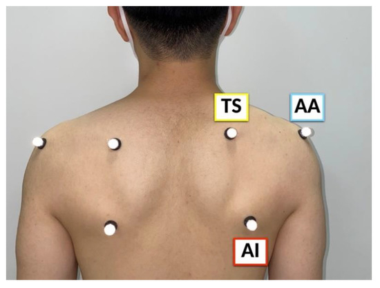Three-Dimensional Quantitative Evaluation of the Scapular Skin Marker ...