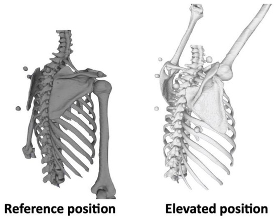 Three-Dimensional Quantitative Evaluation of the Scapular Skin Marker ...