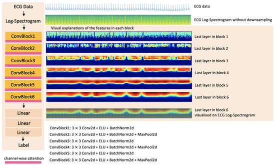 Classification of Tetanus Severity in Intensive-Care Settings for Low ...