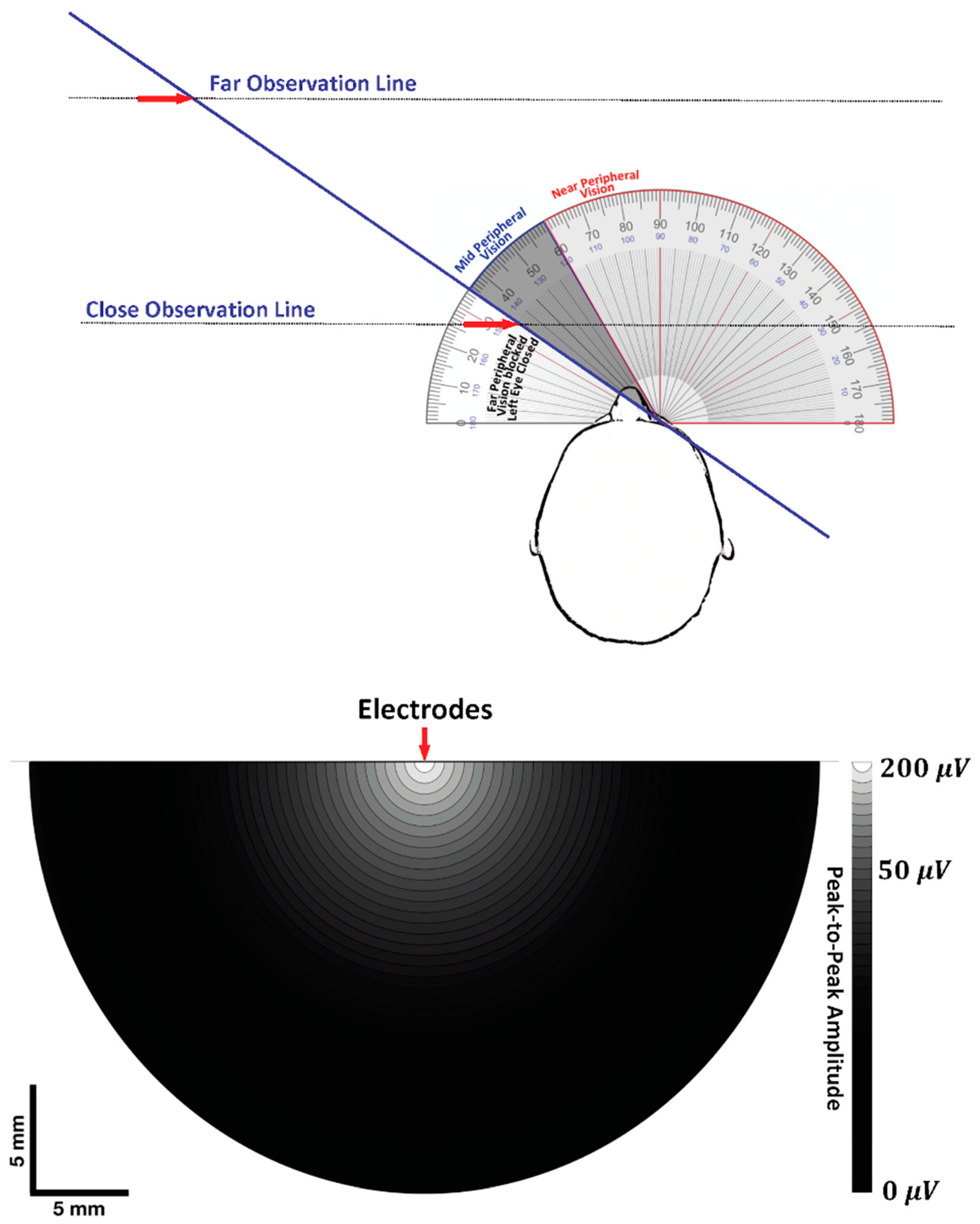Sensors | Free Full-Text | Teaching Essential EMG Theory to Kinesiologists and Physical ...