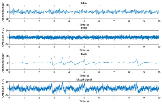Remove Artifacts from a Single-Channel EEG Based on VMD and SOBI