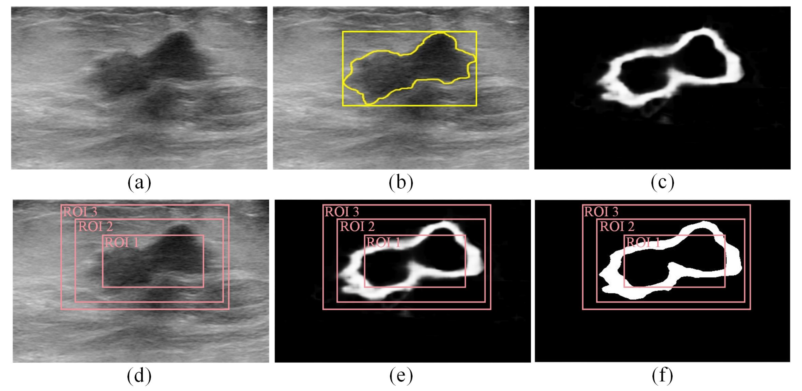 An Edge-Based Selection Method for Improving Regions-of-Interest ...