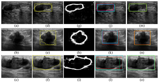An Edge-Based Selection Method for Improving Regions-of-Interest ...
