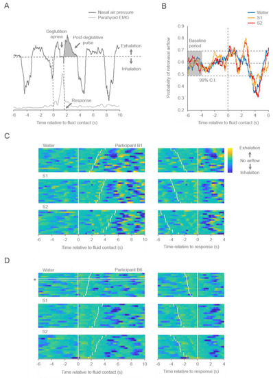 Characterization of Retronasal Airflow Patterns during Intraoral Fluid ...