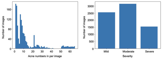 Acne Detection by Ensemble Neural Networks