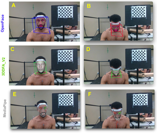 Evaluation of Various State of the Art Head Pose Estimation Algorithms for Clinical Scenarios
