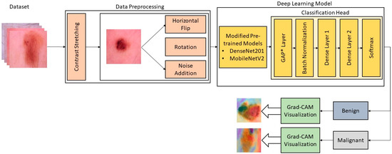 Classification of Skin Cancer Lesions Using Explainable Deep Learning
