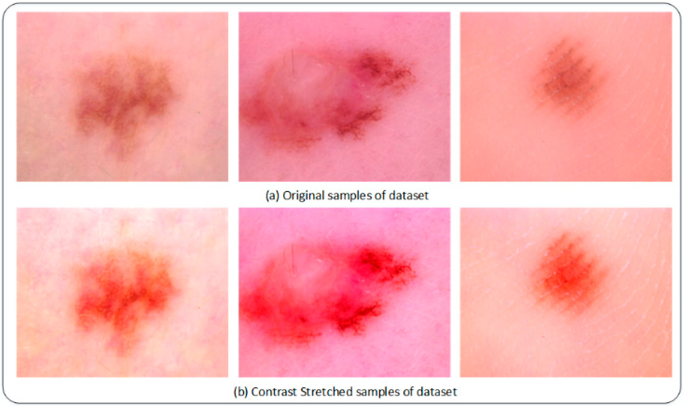 Classification of Skin Cancer Lesions Using Explainable Deep Learning