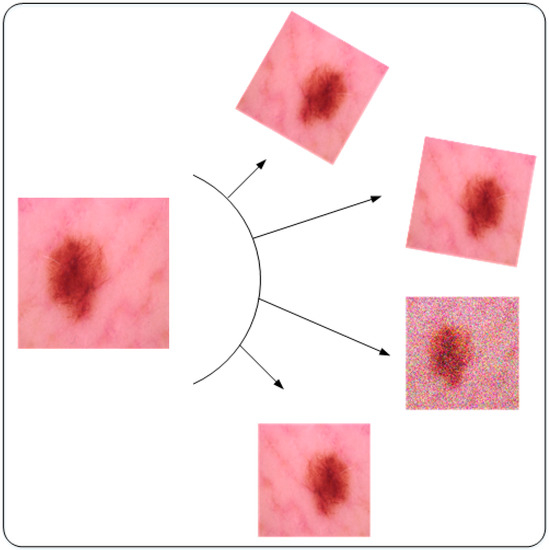 Classification of Skin Cancer Lesions Using Explainable Deep Learning