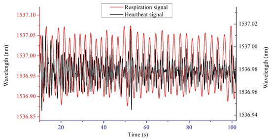 Short-Term HRV Detection and Human Fatigue State Analysis Based on ...