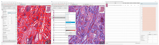 Detection on Cell Cancer Using the Deep Transfer Learning and Histogram ...