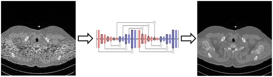 Sensors | Free Full-Text | Image Recovery from Synthetic Noise ...