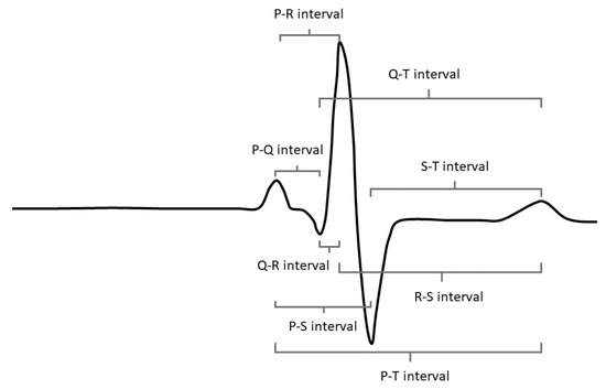 Utility of the Full ECG Waveform for Stress Classification