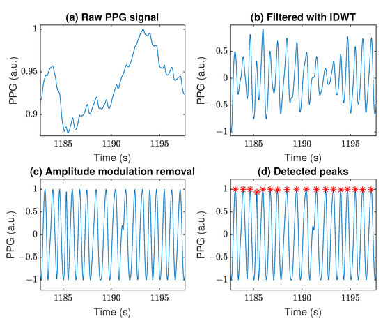 Processing Photoplethysmograms Recorded by Smartwatches to Improve the ...