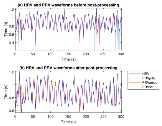 Processing Photoplethysmograms Recorded by Smartwatches to Improve the ...