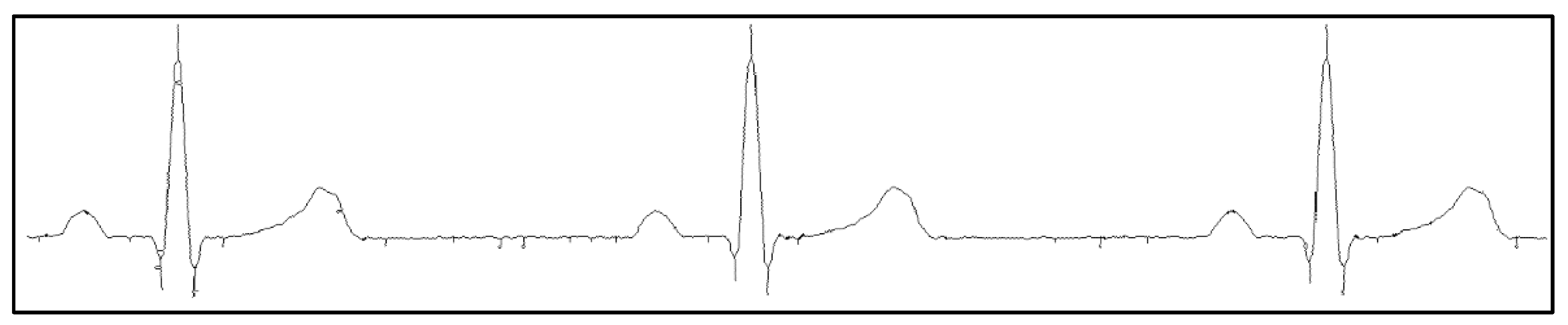 Development and Validation of an Algorithm for the Digitization of ECG Paper Images