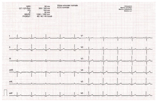 Development and Validation of an Algorithm for the Digitization of ECG Paper Images