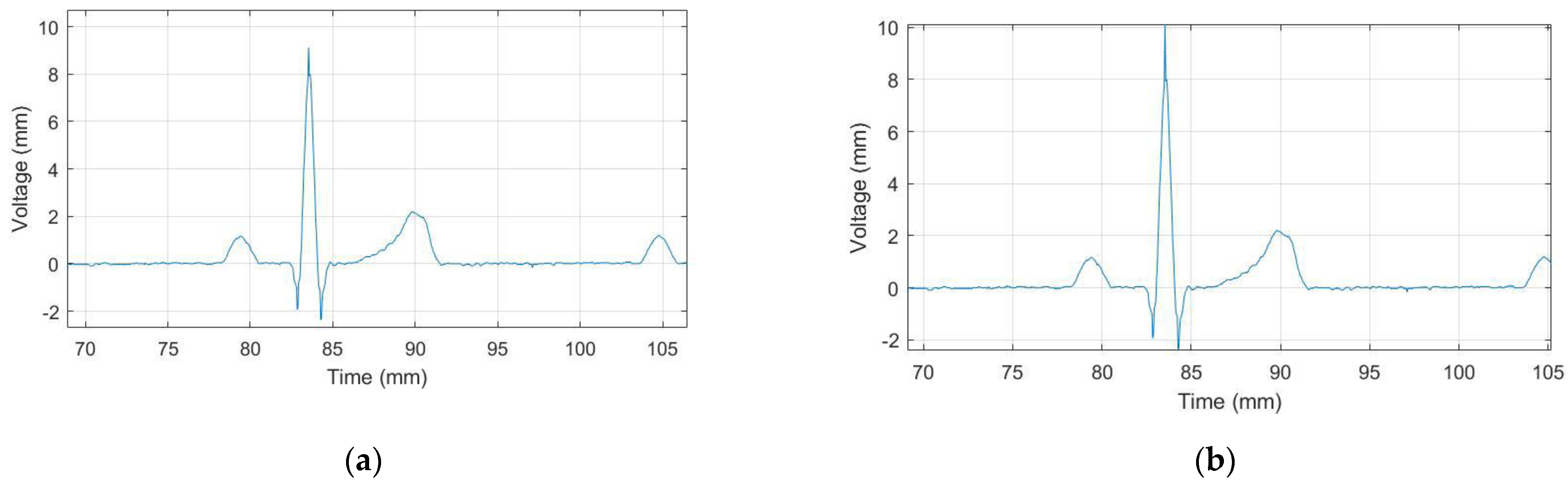Development and Validation of an Algorithm for the Digitization of ECG ...