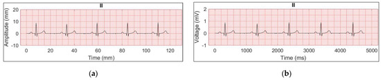 Development and Validation of an Algorithm for the Digitization of ECG Paper Images