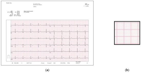Development and Validation of an Algorithm for the Digitization of ECG ...