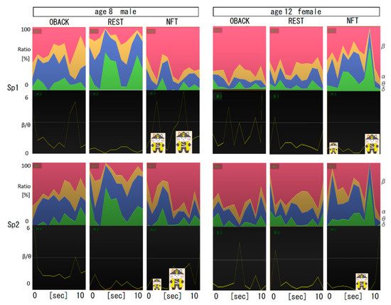 Simplified Attachable EEG Revealed Child Development Dependent ...