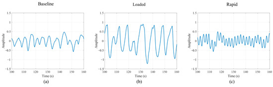 Optical Monitoring of Breathing Patterns and Tissue Oxygenation: A ...