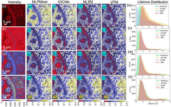 Simple and Robust Deep Learning Approach for Fast Fluorescence Lifetime Imaging