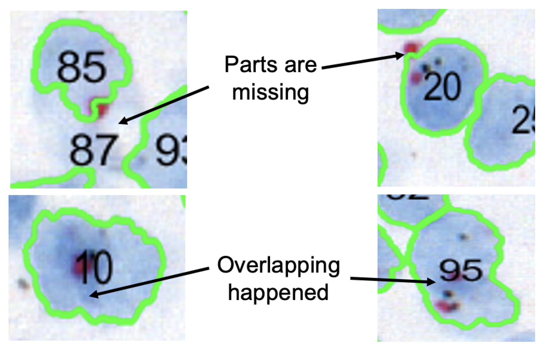 Sensors | Free Full-Text | Singular Nuclei Segmentation for Automatic HER2 Quantification Using ...