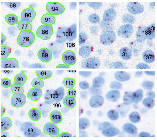 Sensors | Free Full-Text | Singular Nuclei Segmentation for Automatic HER2 Quantification Using ...