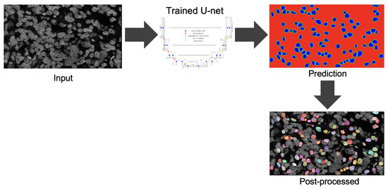 Sensors | Free Full-Text | Singular Nuclei Segmentation for Automatic HER2 Quantification Using ...