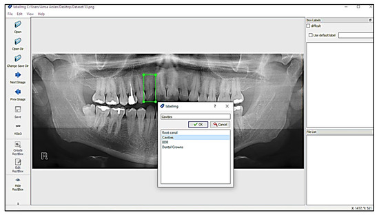 Sensors | Free Full-Text | Deep Learning Models for Classification of ...