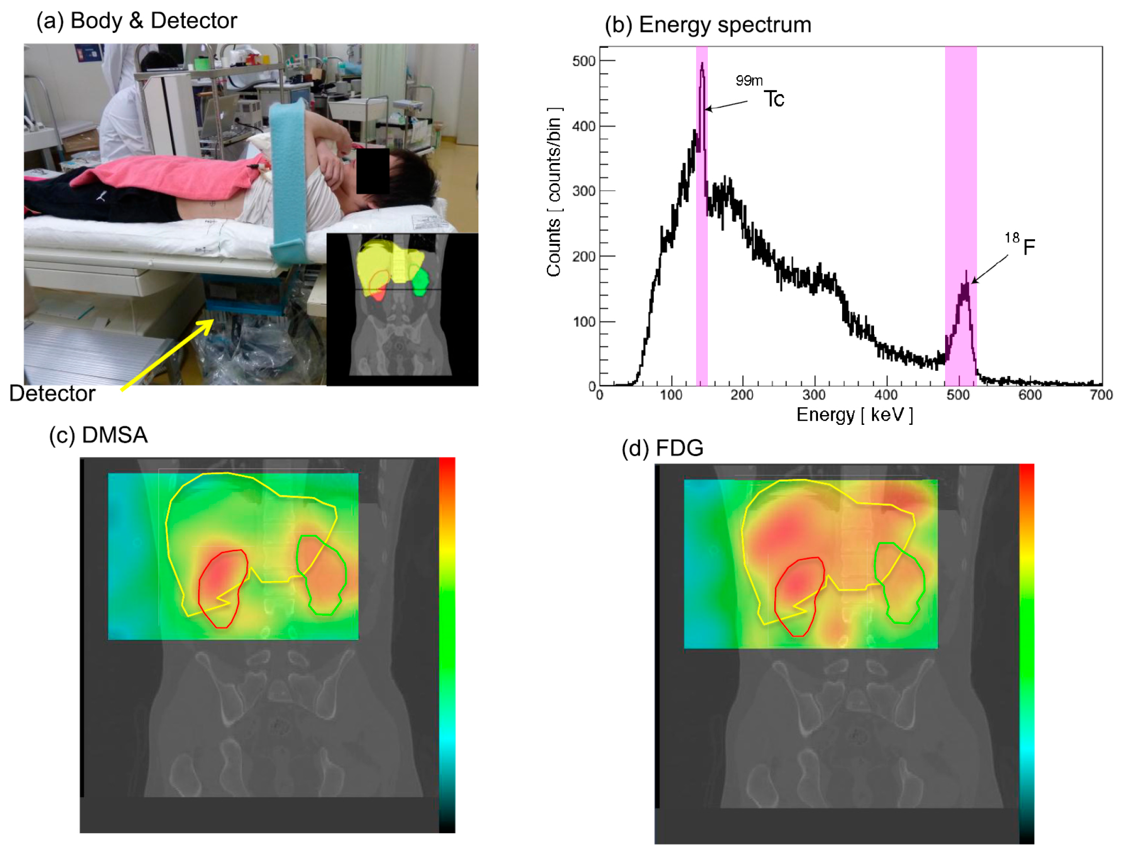 Sensors | Free Full-Text | Development and Applications of Compton Camera—A Review