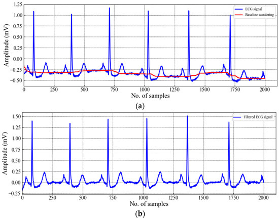 A Parallel Cross Convolutional Recurrent Neural Network for Automatic Imbalanced ECG Arrhythmia ...