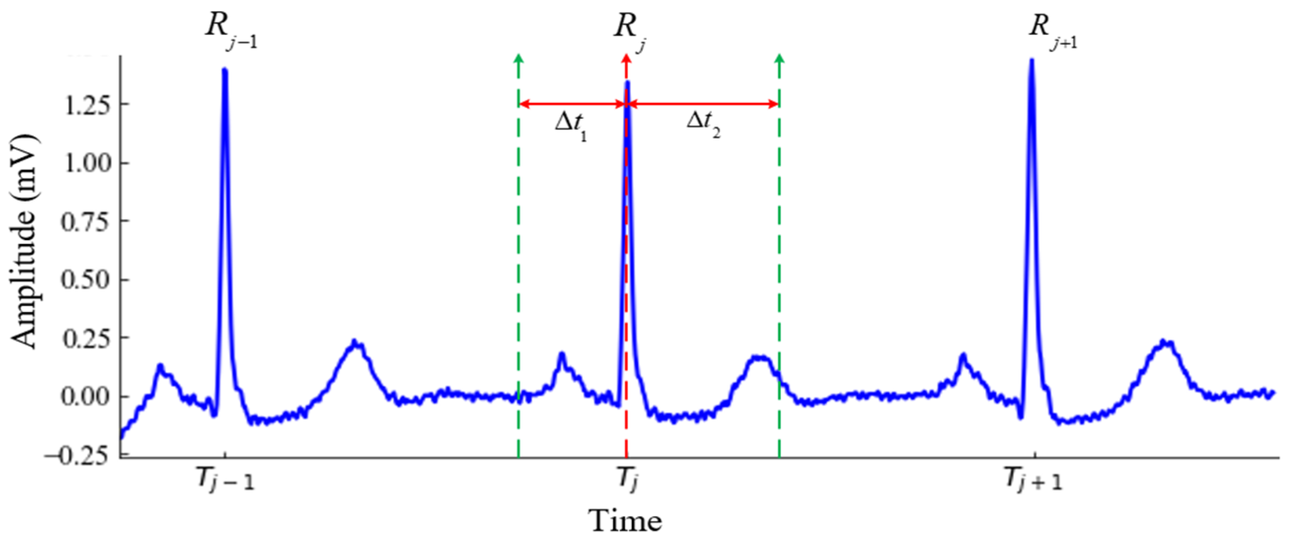 A Parallel Cross Convolutional Recurrent Neural Network for Automatic Imbalanced ECG Arrhythmia ...