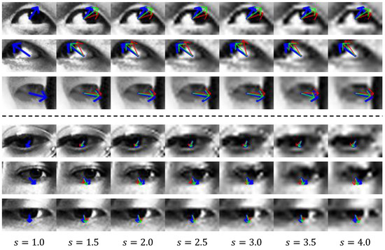 ArbGaze: Gaze Estimation from Arbitrary-Sized Low-Resolution Images