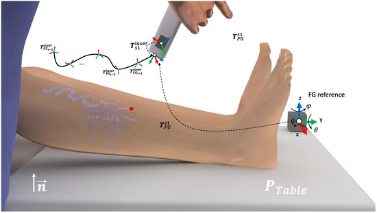 Characterization of the Workspace and Limits of Operation of Laser ...