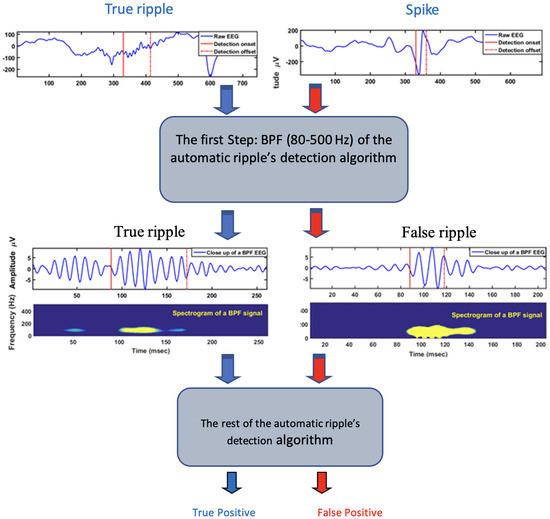 Implementation of a Morphological Filter for Removing Spikes from the Epileptic Brain Signals to ...
