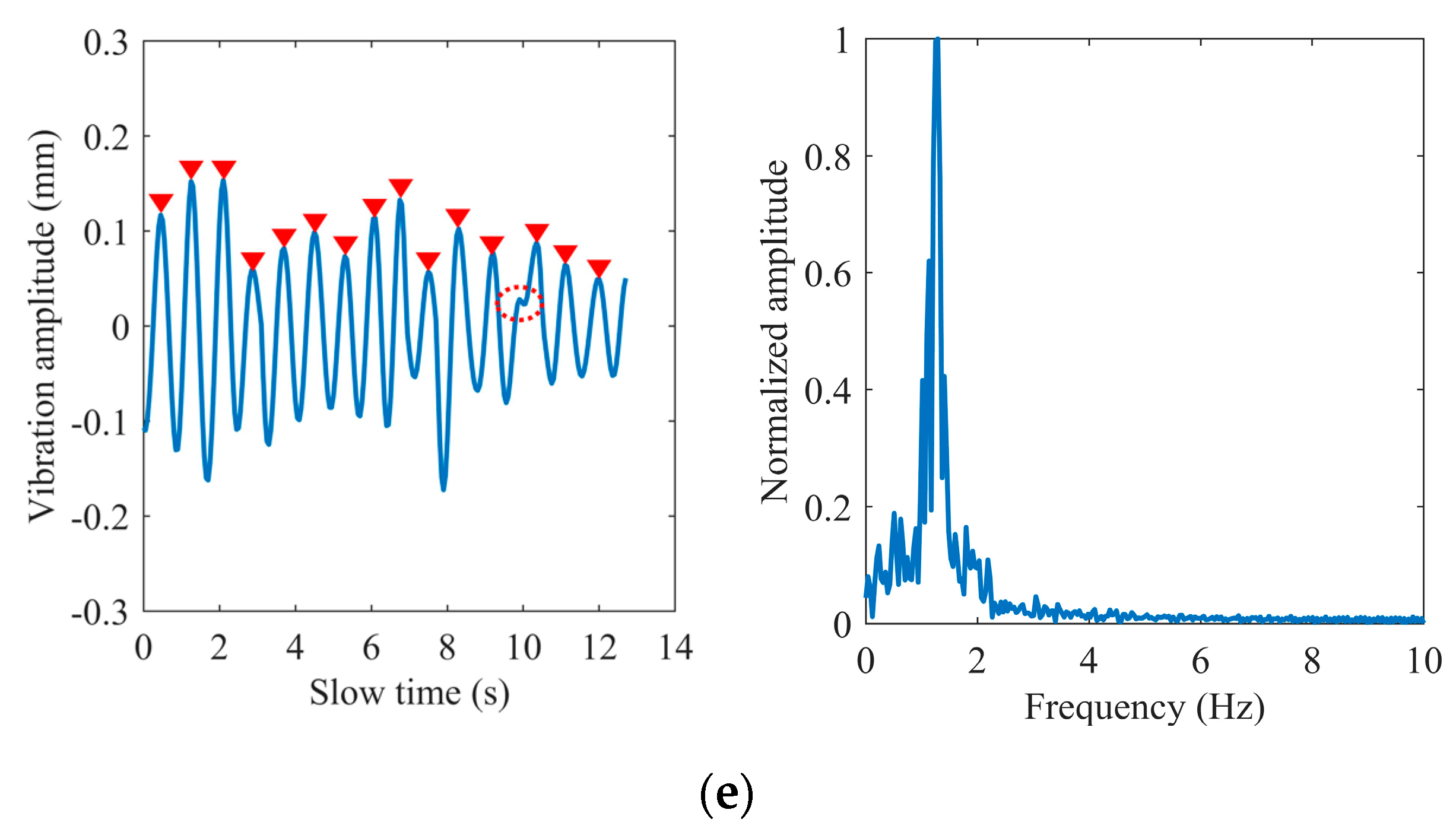 High-Precision Vital Signs Monitoring Method Using a FMCW Millimeter ...