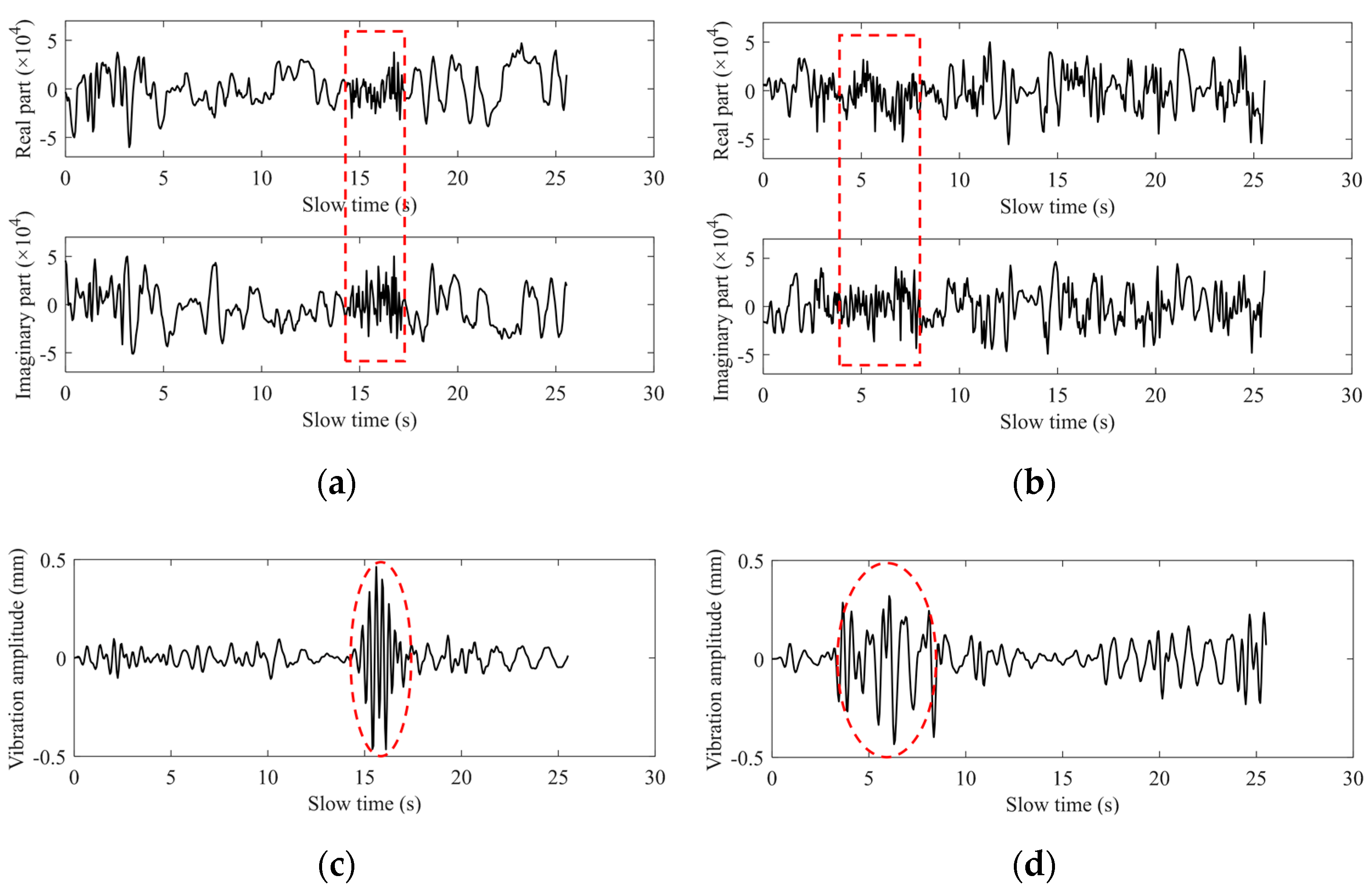 High-Precision Vital Signs Monitoring Method Using a FMCW Millimeter ...